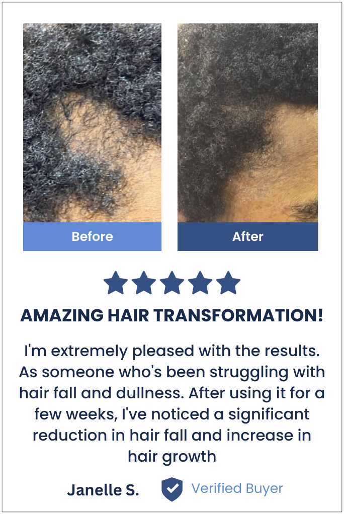 Super Growth Hair Oil Set – Replenhair